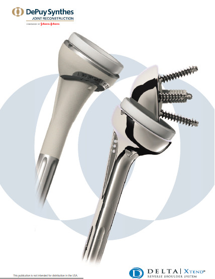 Omgekeerde (reversed) schouderprothese - Eisenhower Kliniek